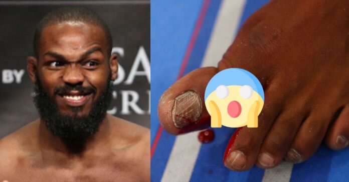 Jon Jones Recalls Nasty Toe Injury Suffered In UFC 159 Fight With Chael ...