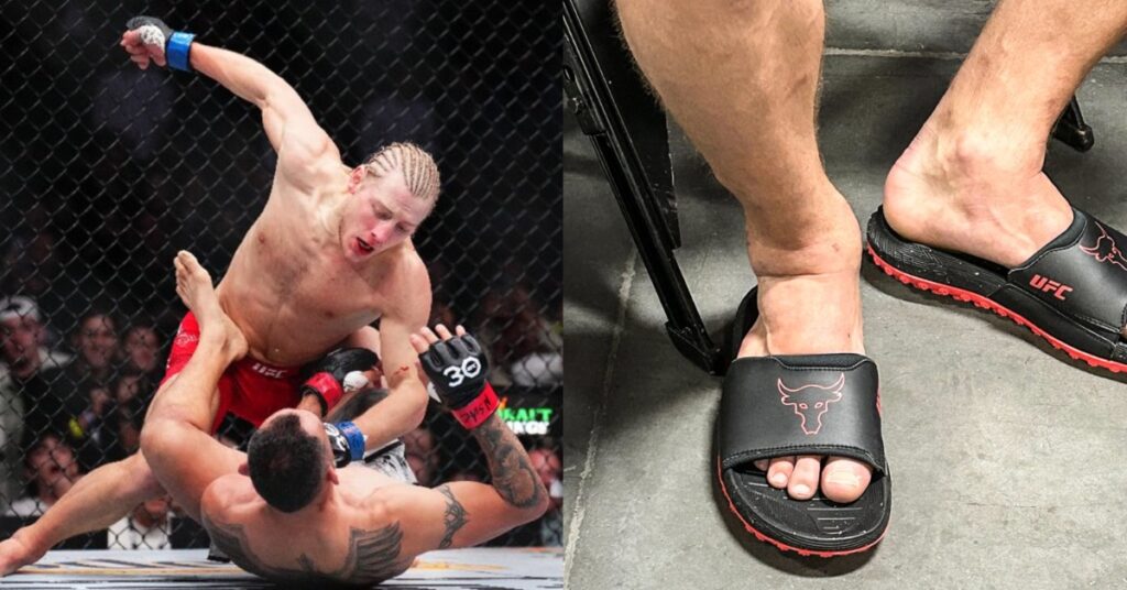 Paddy Pimblett's Foot Is A Mangled Mess Following His UFC 296 Victory ...