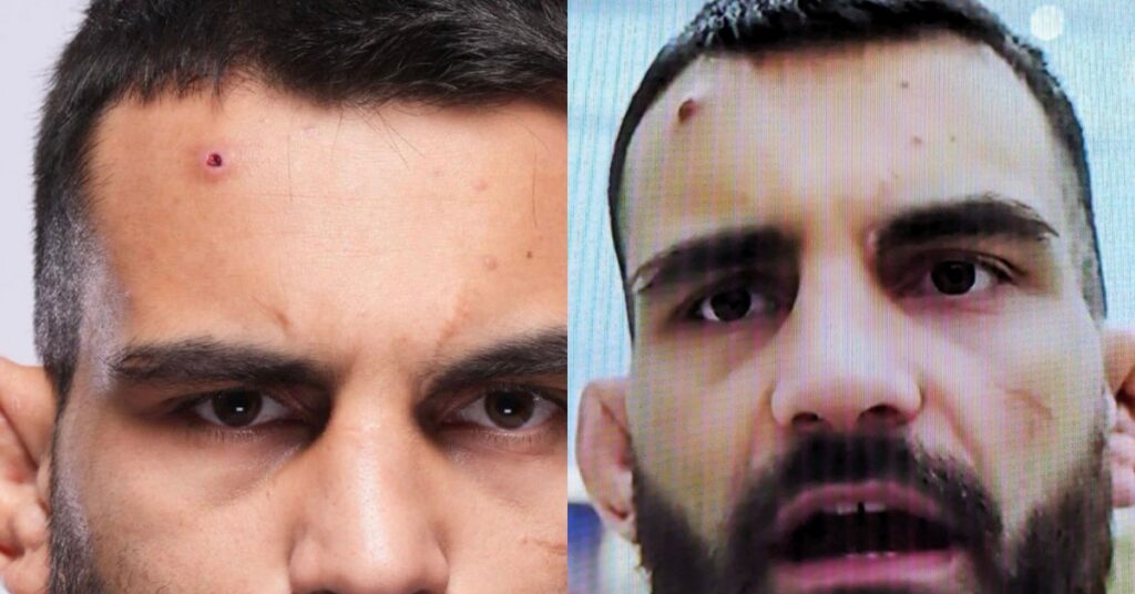 UFC 299 Fight Cast Into Doubt, Fans Speculate Benoit Saint-Denis Struck ...