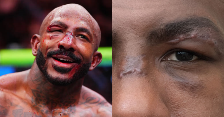 Photos - Khalil Rountree Shows Off Gruesome Scars After UFC 307 Title ...