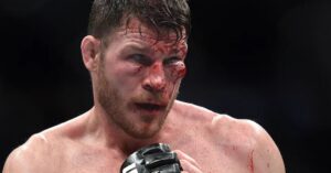 Michael Bisping Reveals How Eye Injury Caused Him Anxiety In The UFC