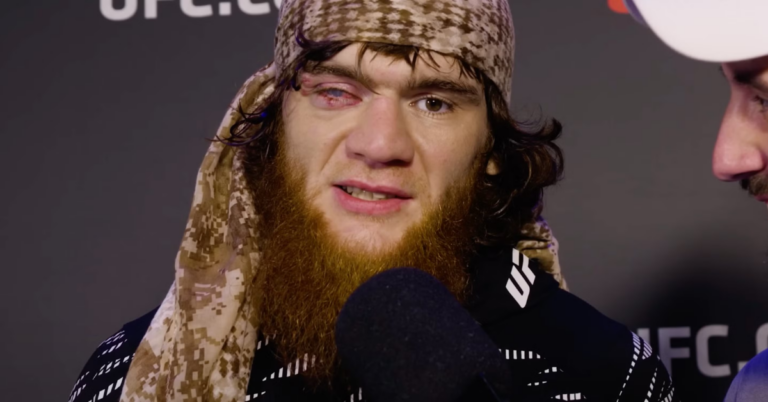 Shara Magomedov Eye Injury: 'Bullet' Reveals The Story Behind Losing ...