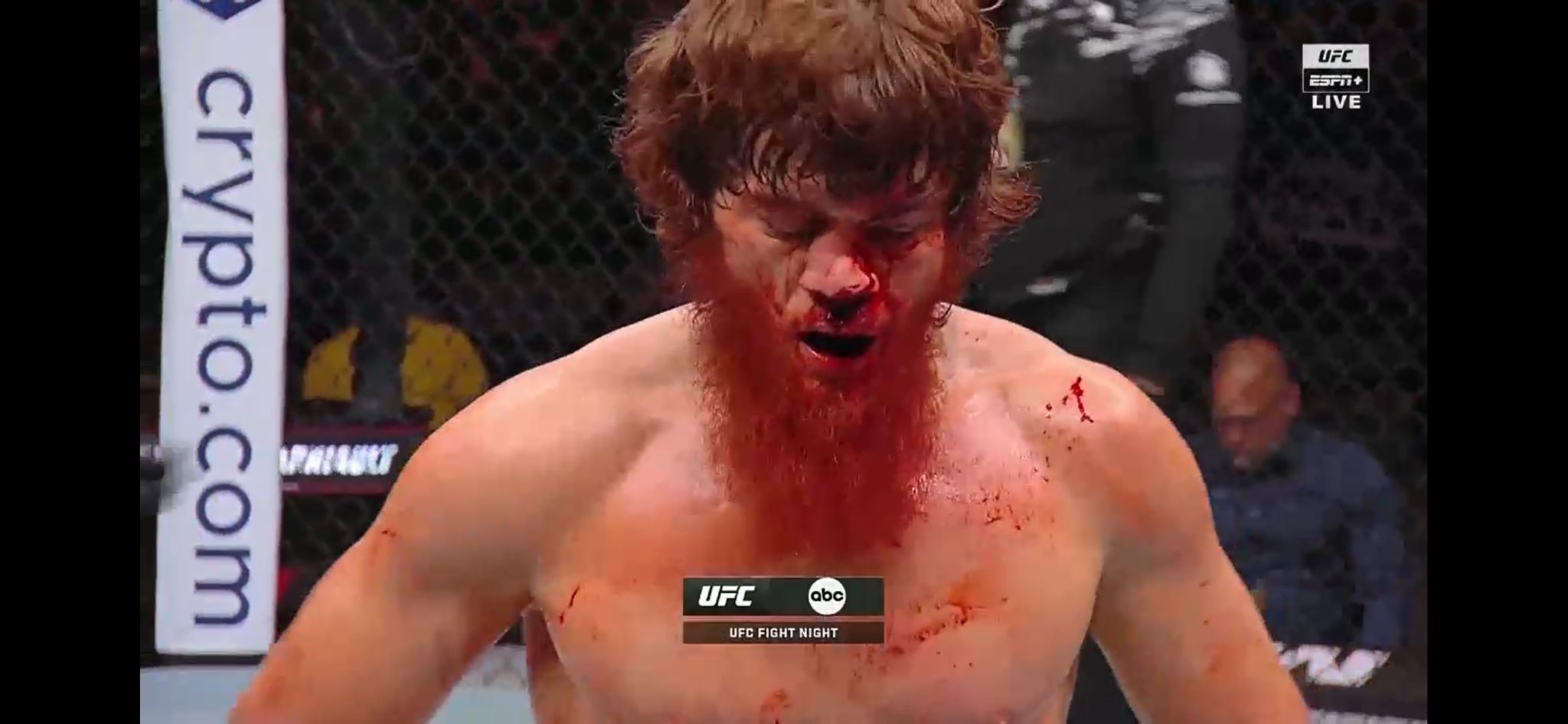 Shara Bullet Hospitalized In Abu Dhabi For Nose Surgery Following UFC Bout