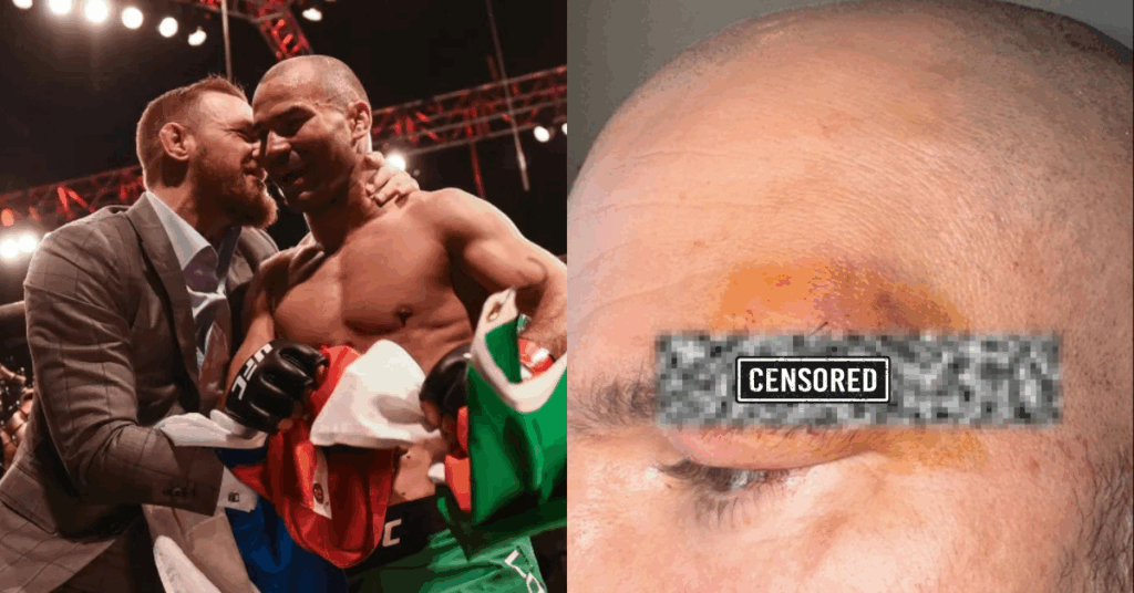 Look: The Gruesome Eyebrow Cut That Forced Artem Lobov To Withdraw From ...